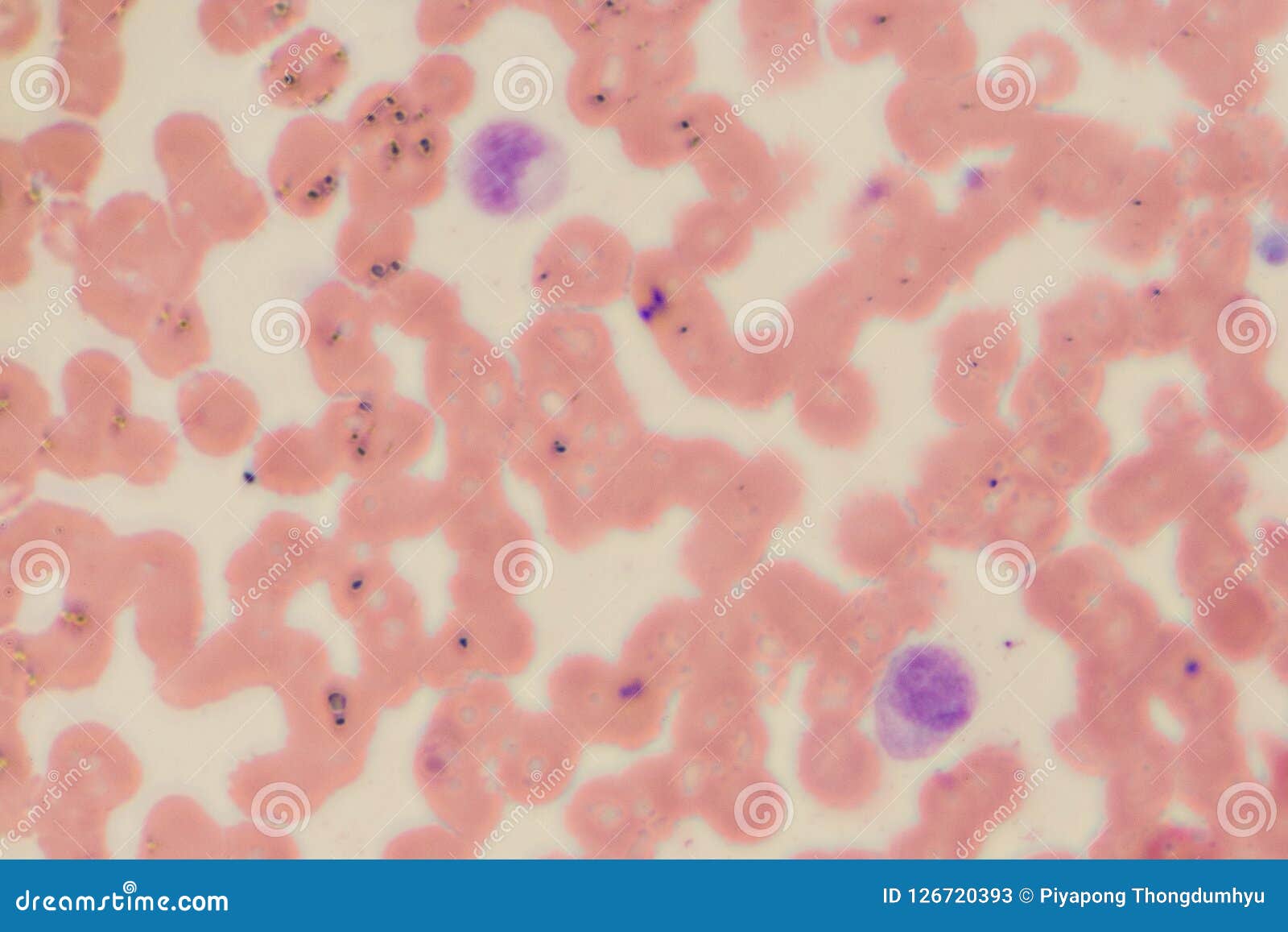 Study of White Blood Cells are the Cells of the Immune System Under the ...