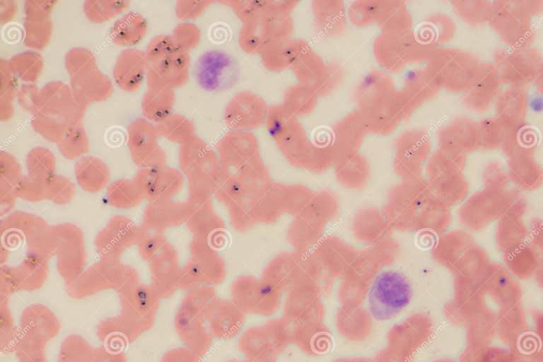 Study of White Blood Cells are the Cells of the Immune System Under the ...