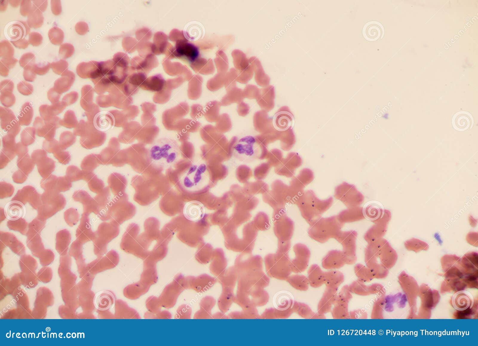 Study of White Blood Cells are the Cells of the Immune System Under the ...