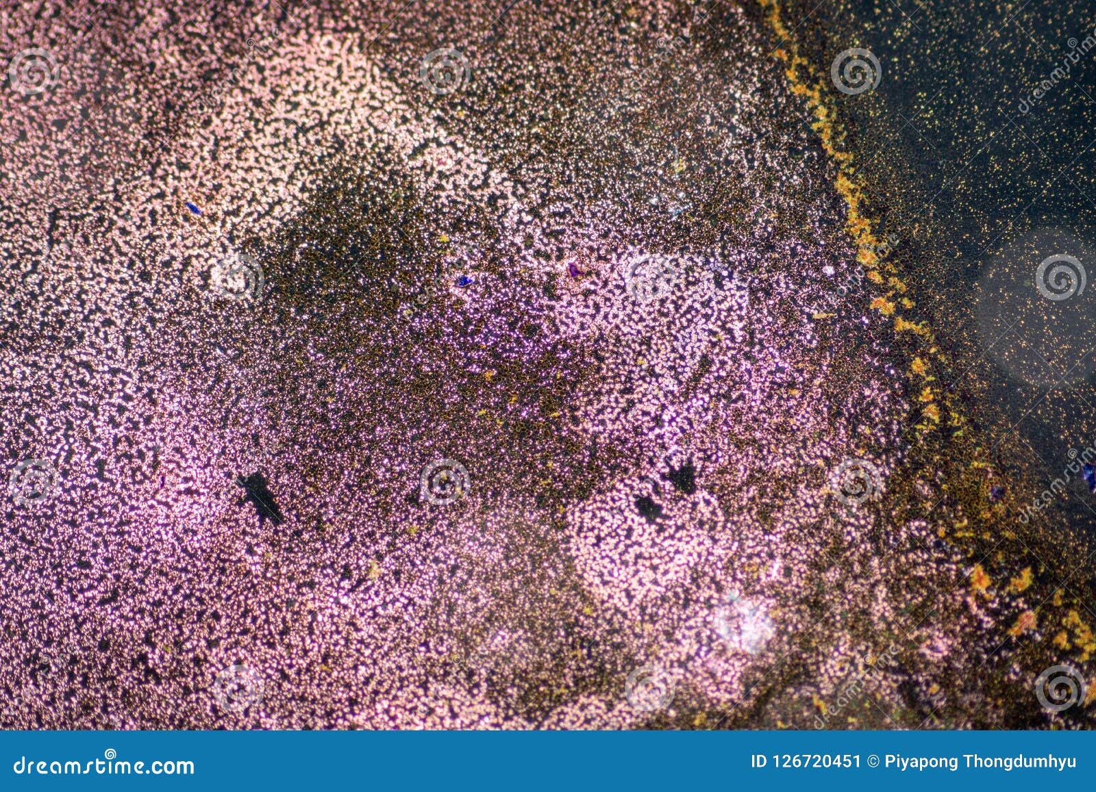 Study of White Blood Cells are the Cells of the Immune System Under the ...