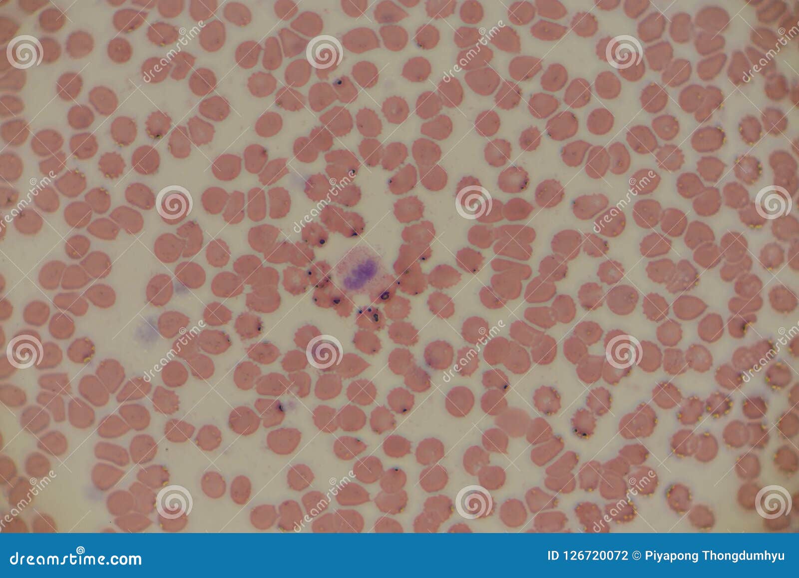 Study of White Blood Cells are the Cells of the Immune System Under the ...