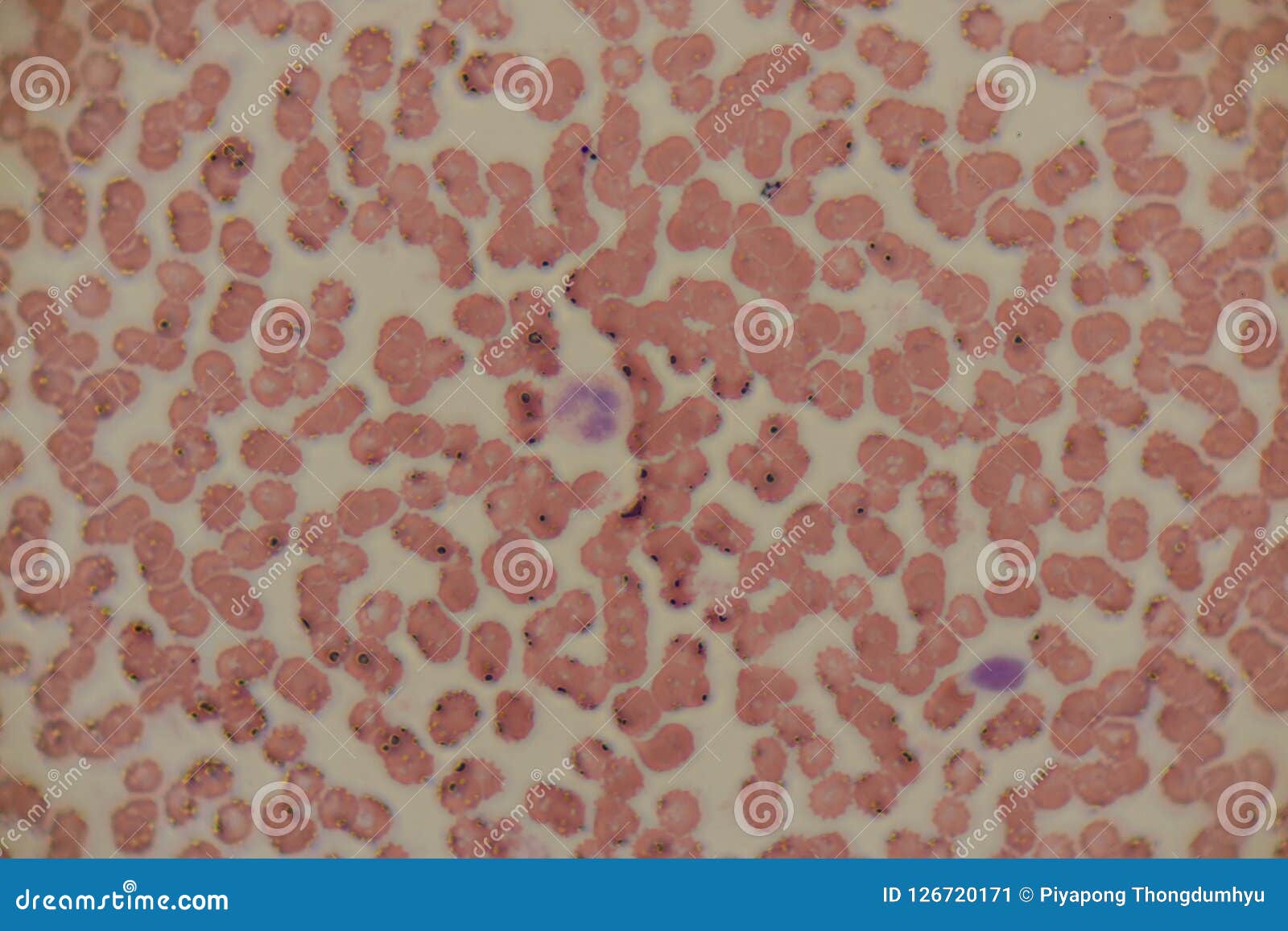 Study of White Blood Cells are the Cells of the Immune System Under the ...