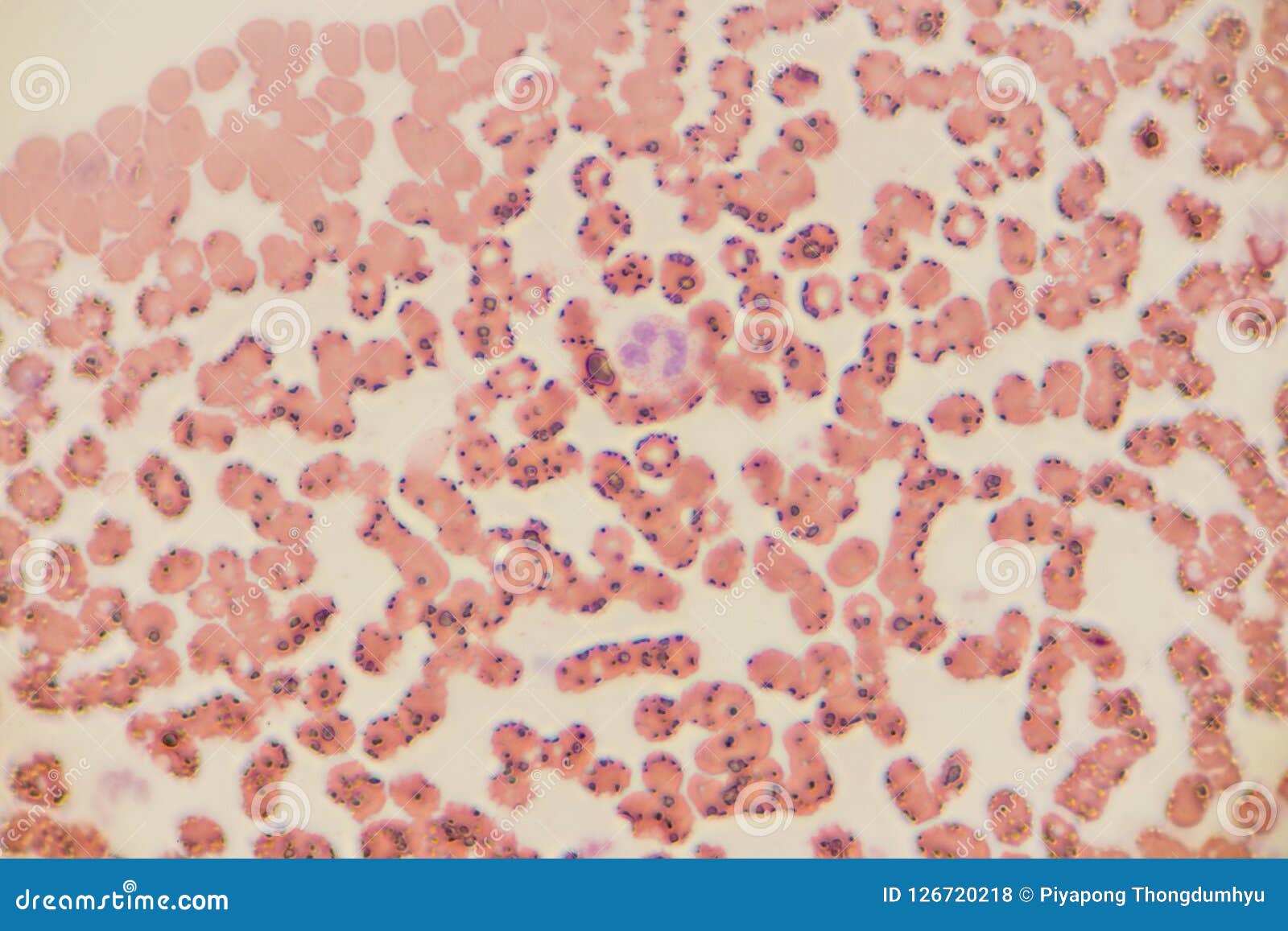 Study of White Blood Cells are the Cells of the Immune System Under the ...