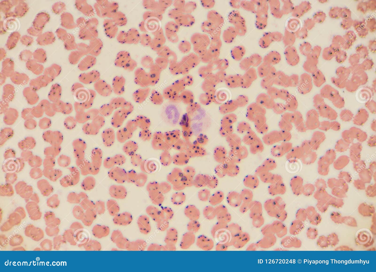 Study of White Blood Cells are the Cells of the Immune System Under the ...