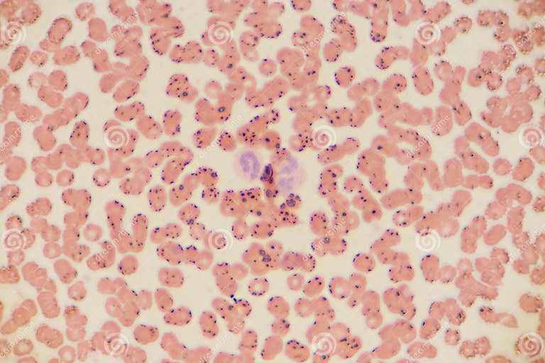 Study of White Blood Cells are the Cells of the Immune System Under the ...