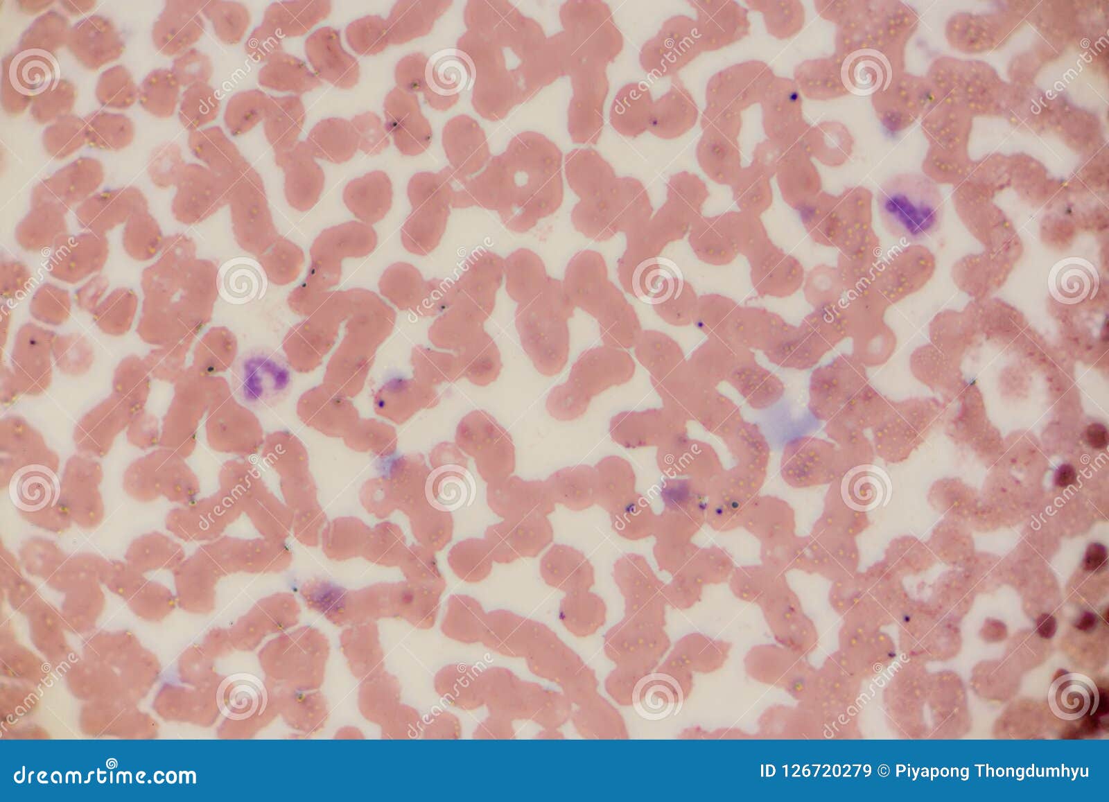 Study of White Blood Cells are the Cells of the Immune System Under the ...