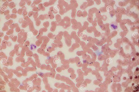 Study of White Blood Cells are the Cells of the Immune System Under the ...