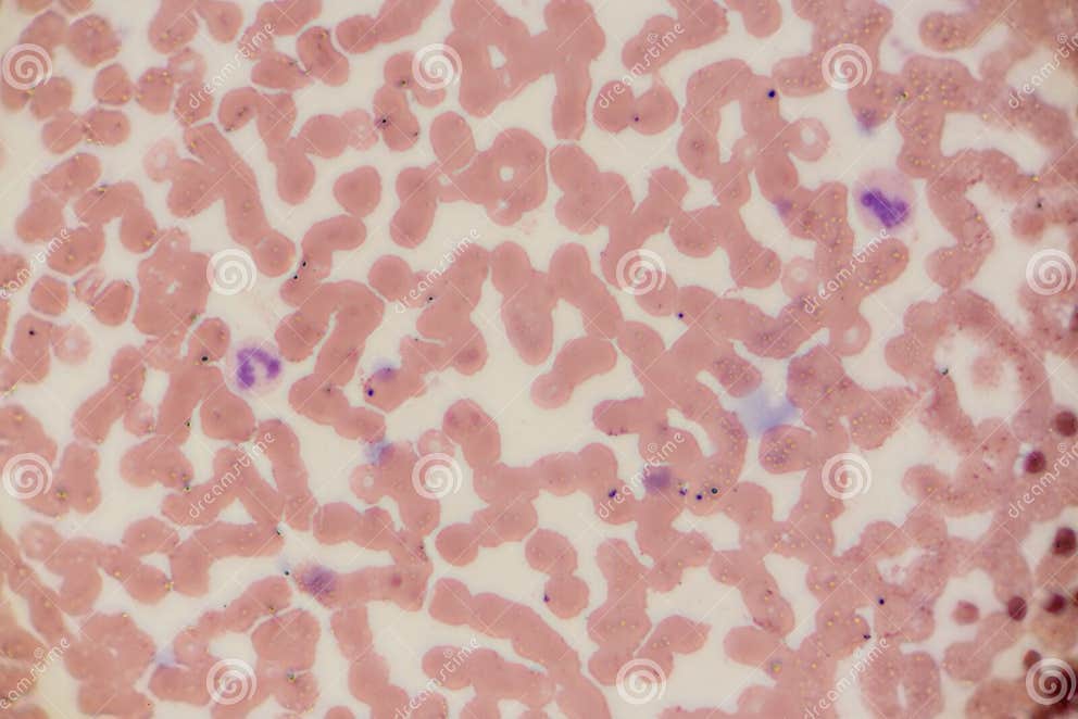 Study of White Blood Cells are the Cells of the Immune System Under the ...