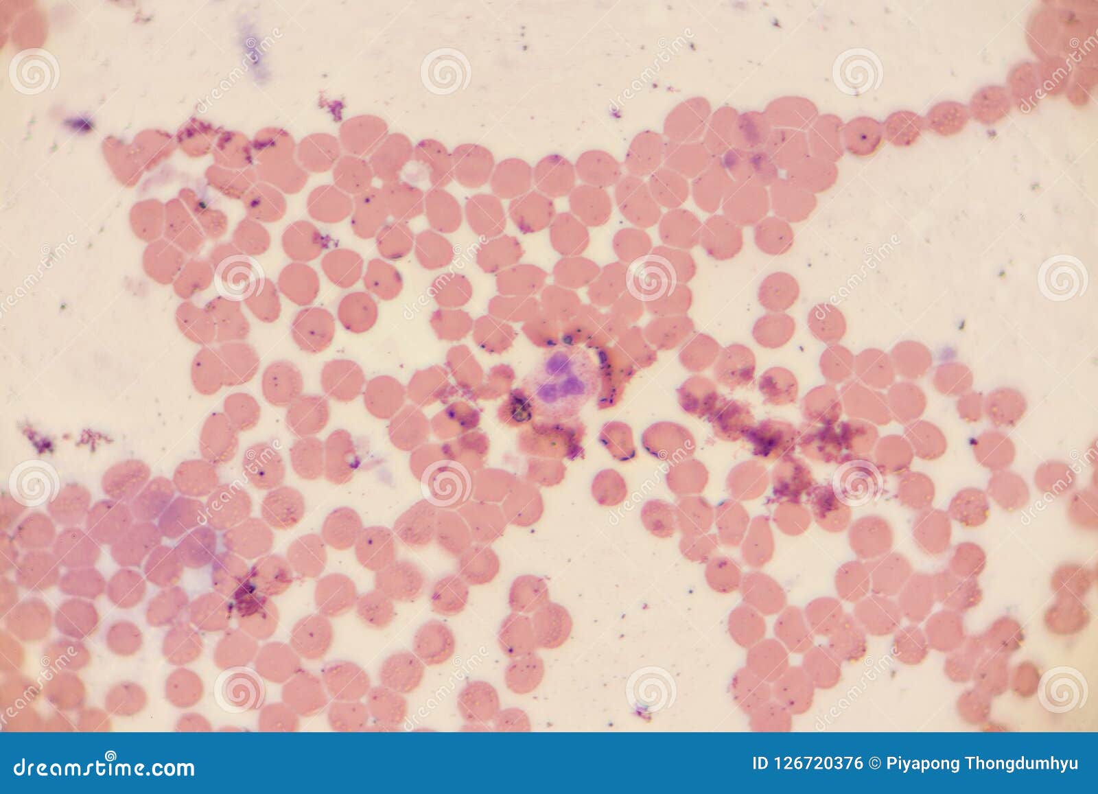 Study of White Blood Cells are the Cells of the Immune System Under the ...