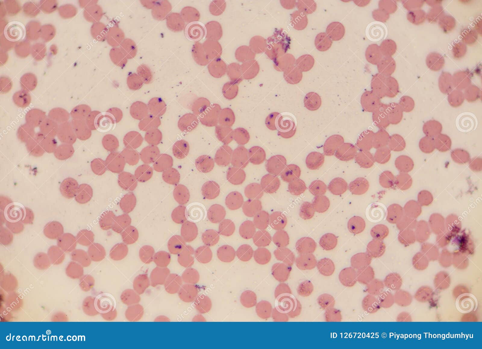 Study of White Blood Cells are the Cells of the Immune System Under the ...