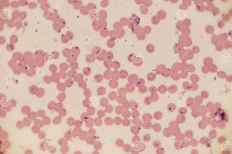 Study of White Blood Cells are the Cells of the Immune System Under the ...