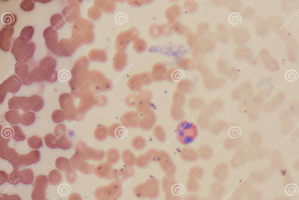 Study of White Blood Cells are the Cells of the Immune System Under the ...