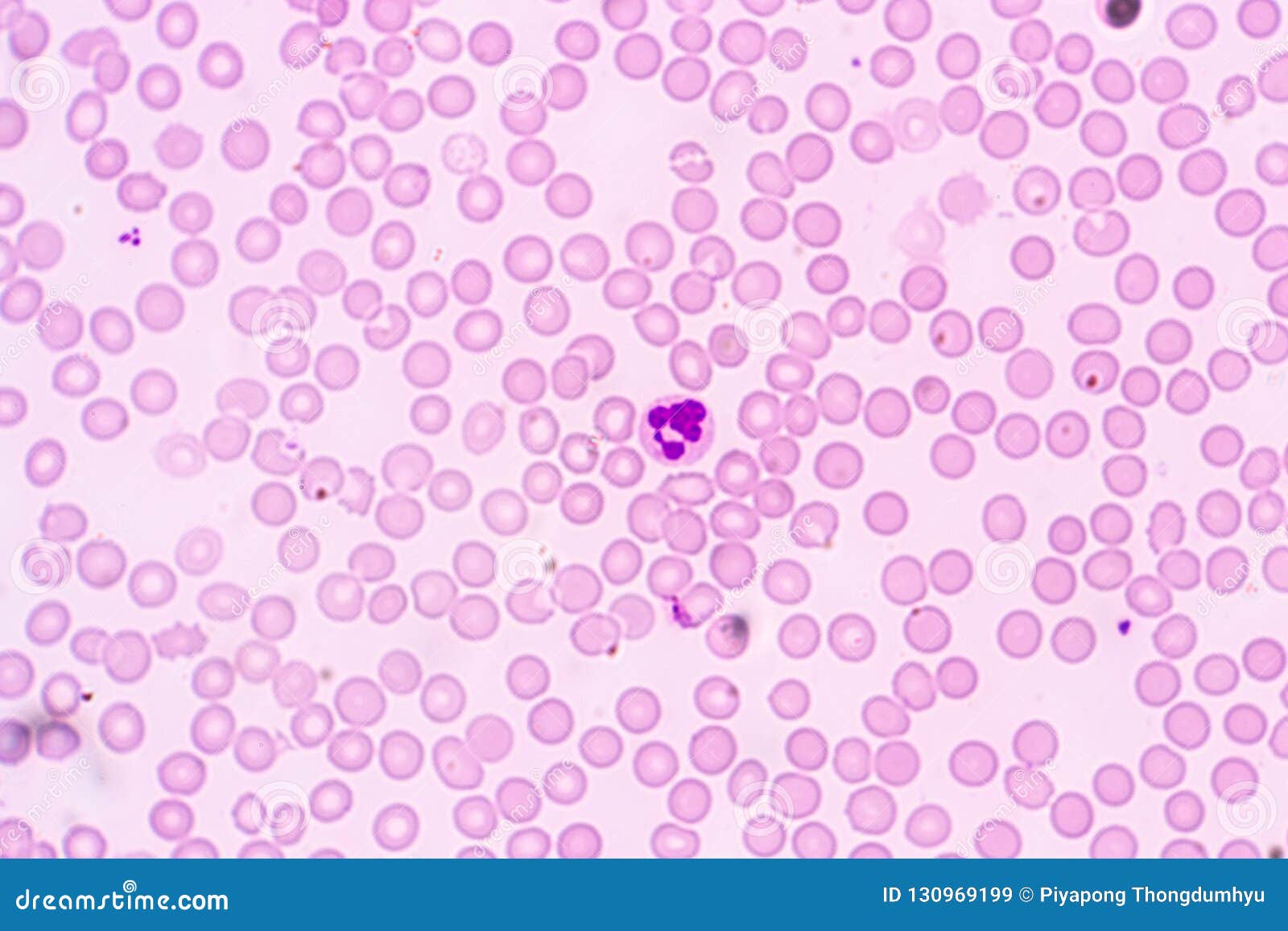 White Blood Cells are the Cells of the Immune System Under the ...