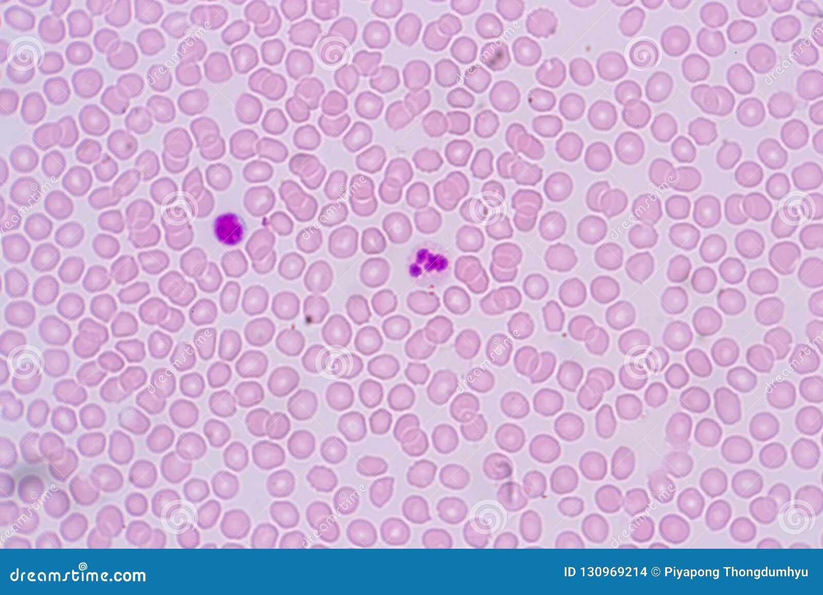 White Blood Cells are the Cells of the Immune System Under the ...