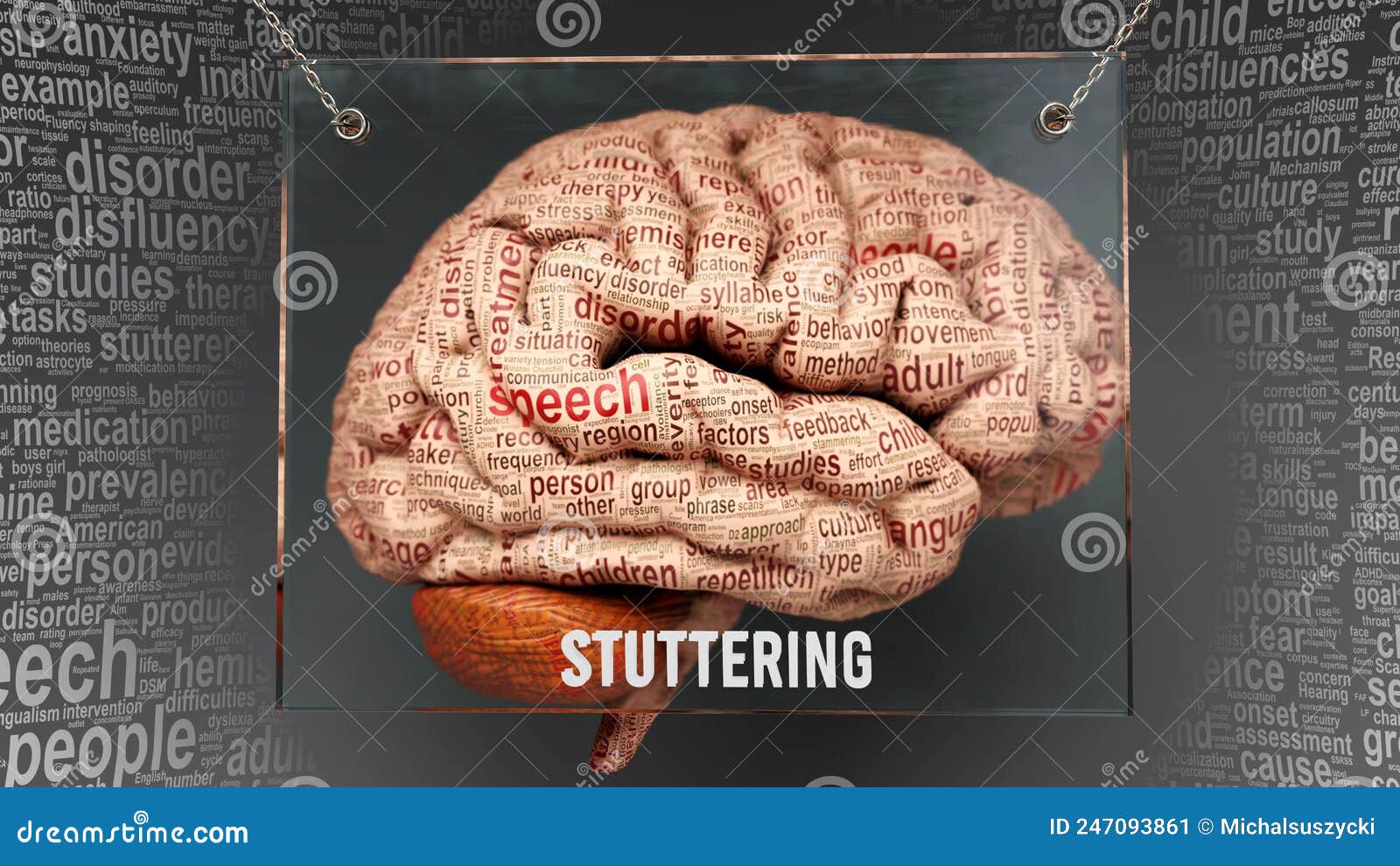 Stuttering in human brain stock illustration. Illustration of cortex ...