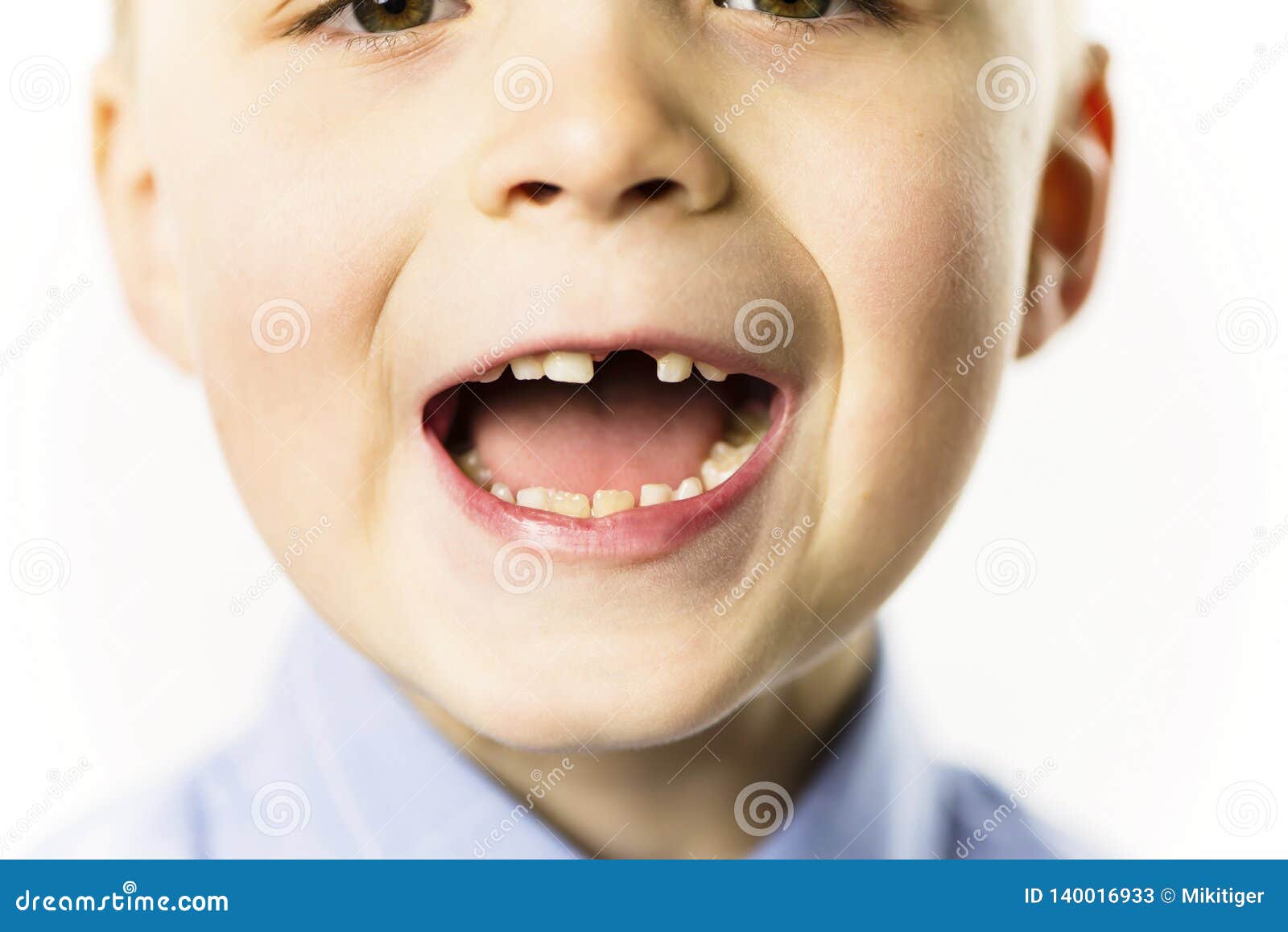 Stylish Boy without a Front Tooth is Smiling Stock Image - Image of ...