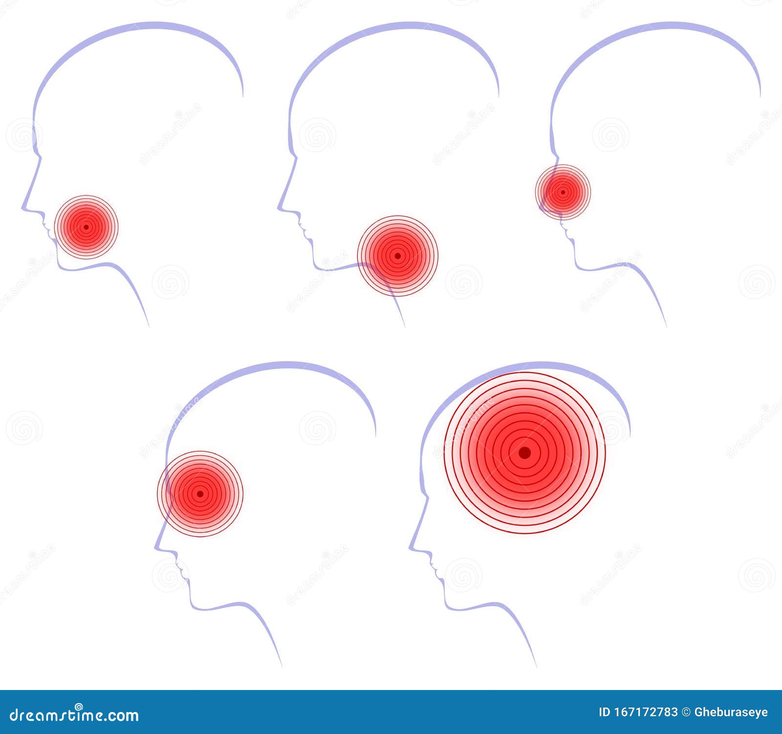 Stylized Face in Profile with Pain, Health, Isolated 库存图片 - 插画 包括有 脖子 ...