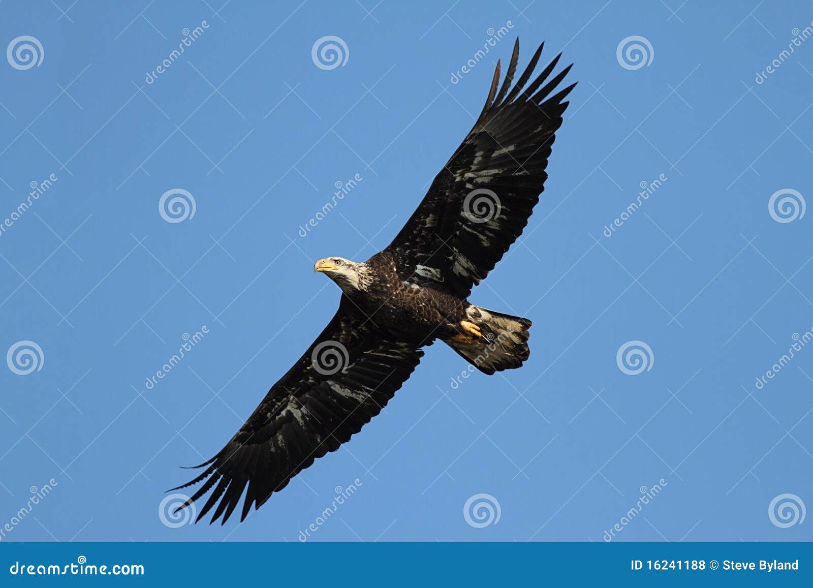 Adult Bald Male Holding Hairbrush, Suffering Alopecia, Looking Up With ...