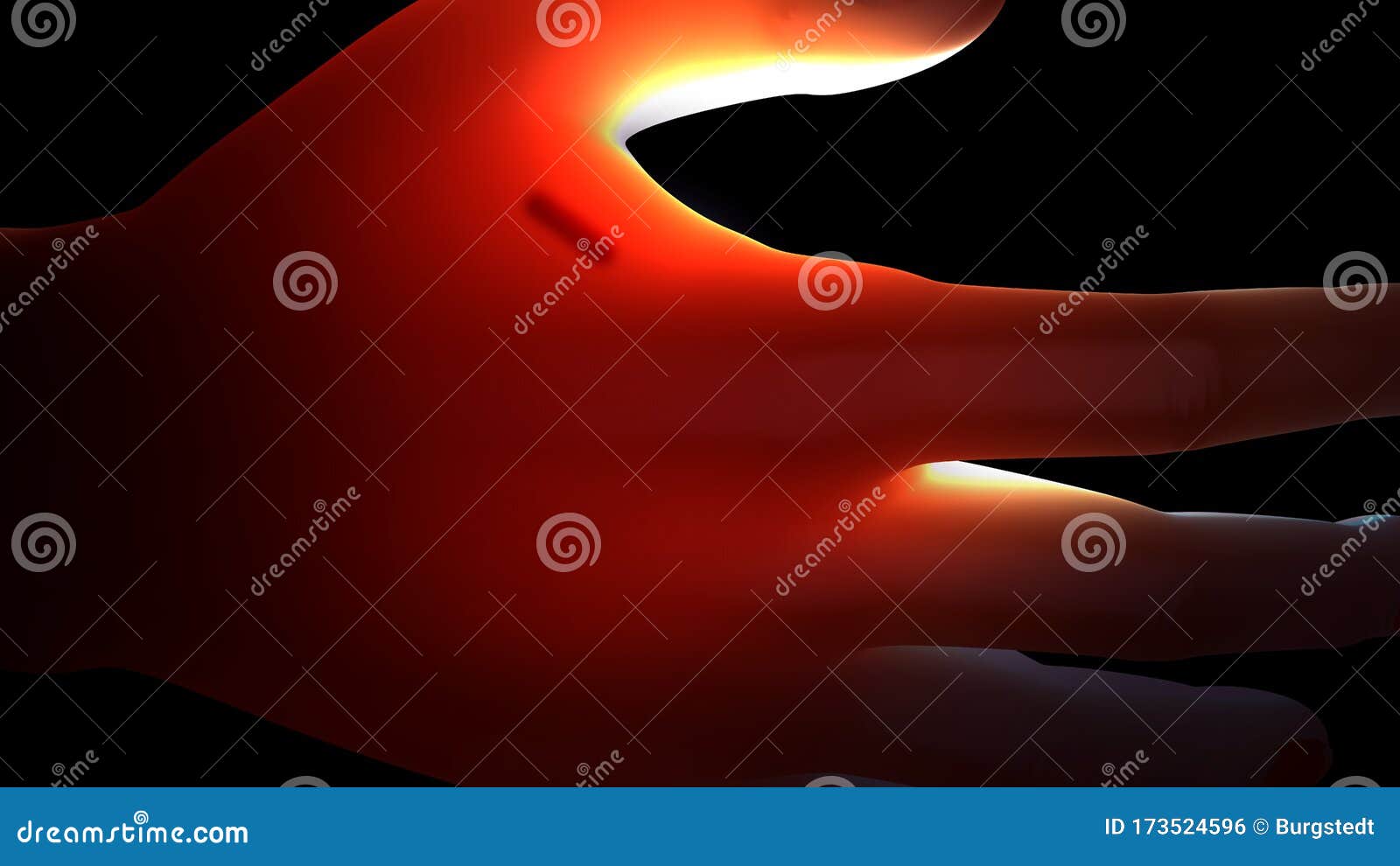 Sub Dermal Microchip Implant or Transponder Implanted into Human Hand ...