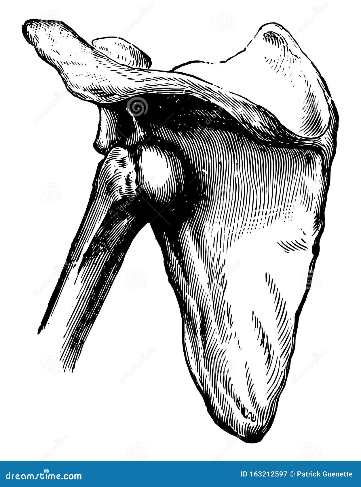 Hip Dislocation Illustration Cartoon Vector | CartoonDealer.com #258914749