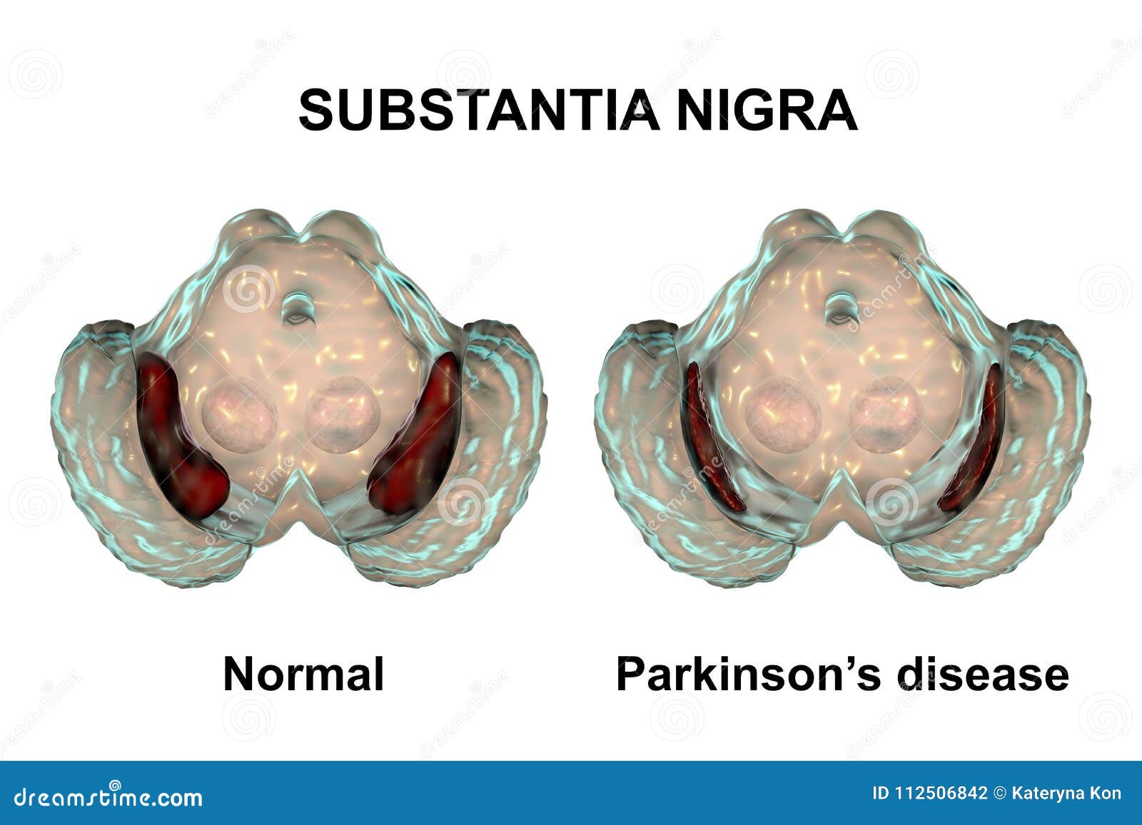 Substantia Nigra Of The Midbrain And Its Dopaminergic Neurons, 3D ...