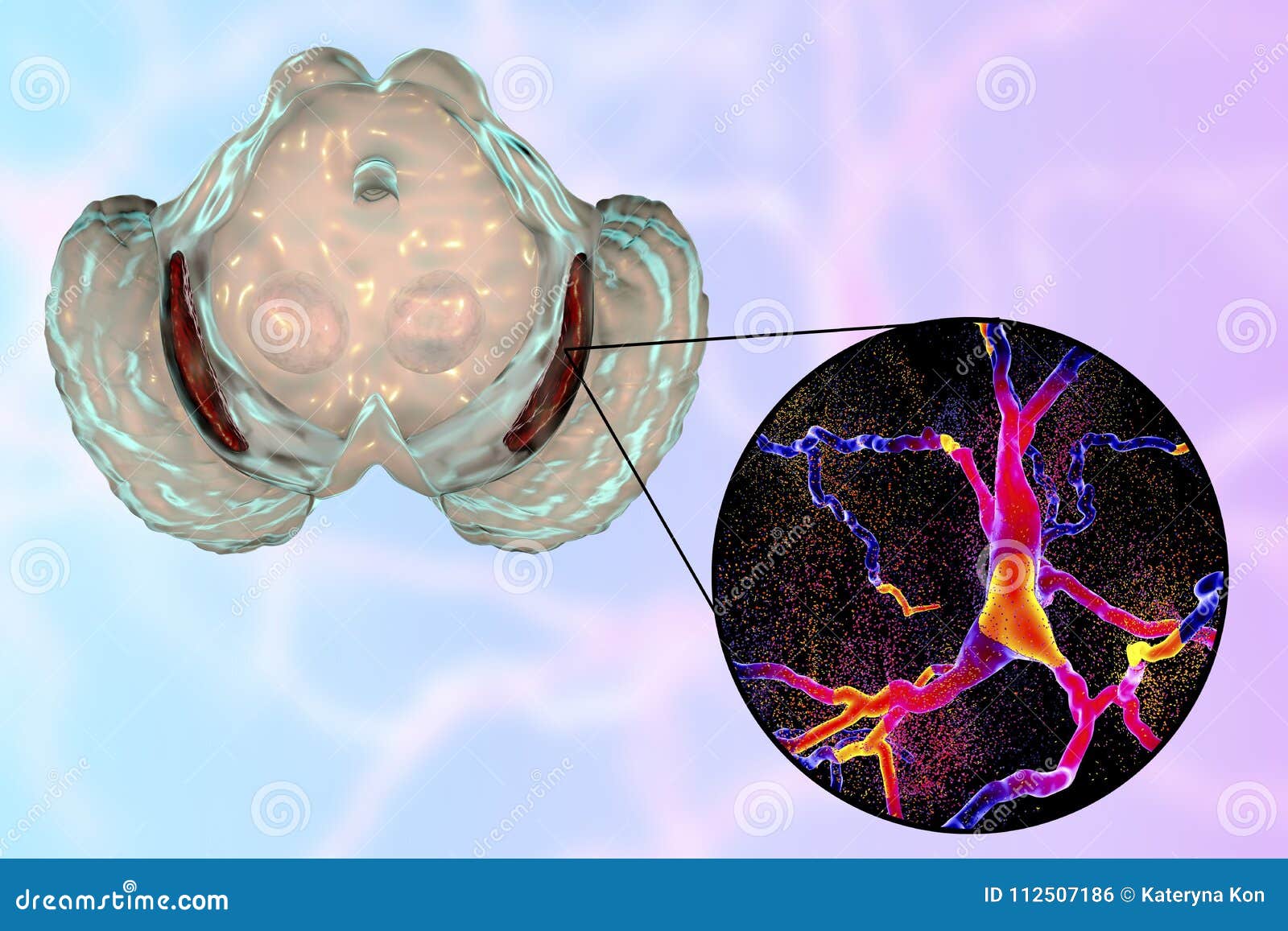 Substantia Nigra Parkinsons Disease