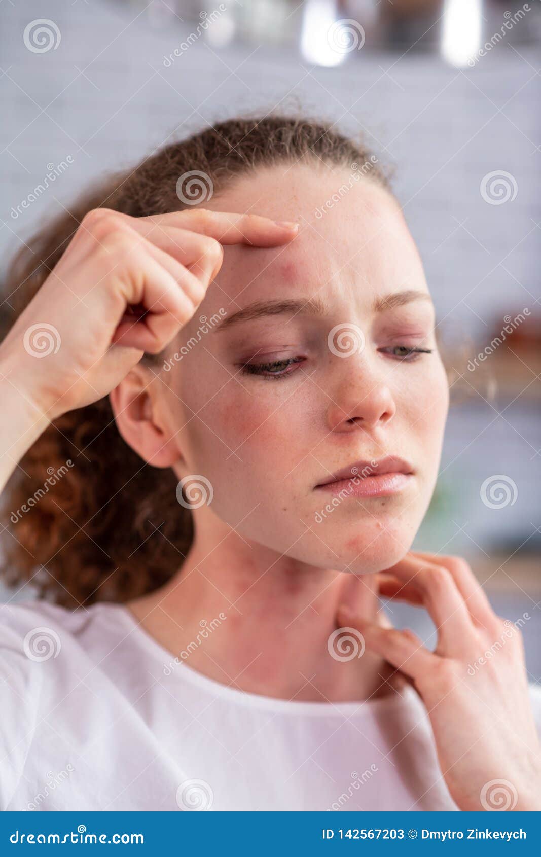 Miserable Long-haired Lady Having Problems with Skin Stock Image ...