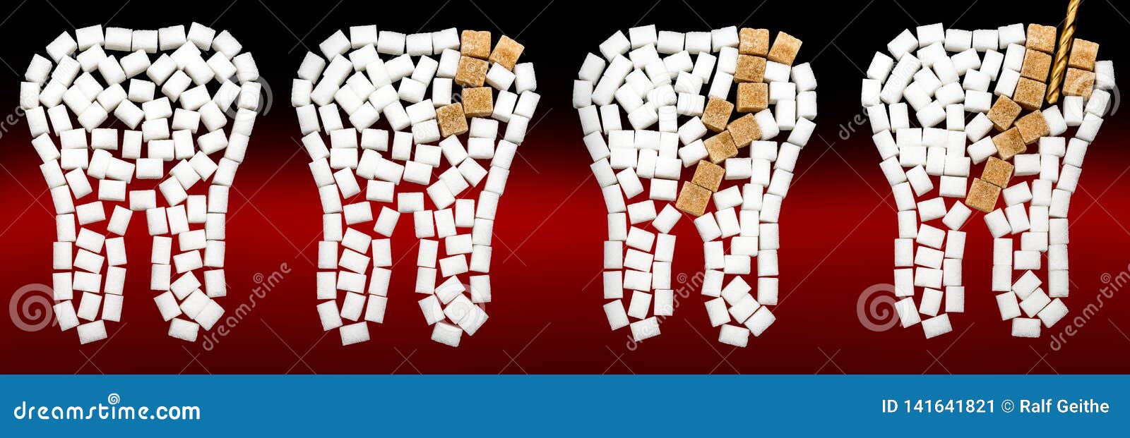 Sugar Caries on the Tooth Presented with Cube Sugar Teeth Stock Image ...