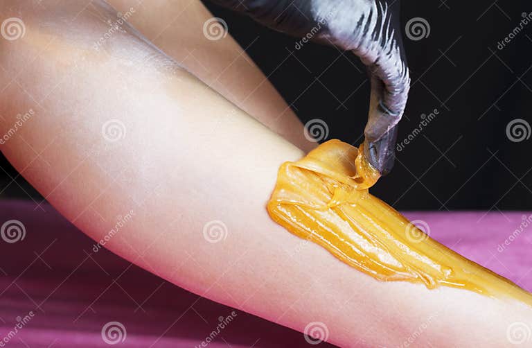Sugaring Epilation with Liquate Sugar at Legs Stock Photo - Image of ... Sugaring Epilation with Liquate Sugar at Legs Stock Photo - Image of ...