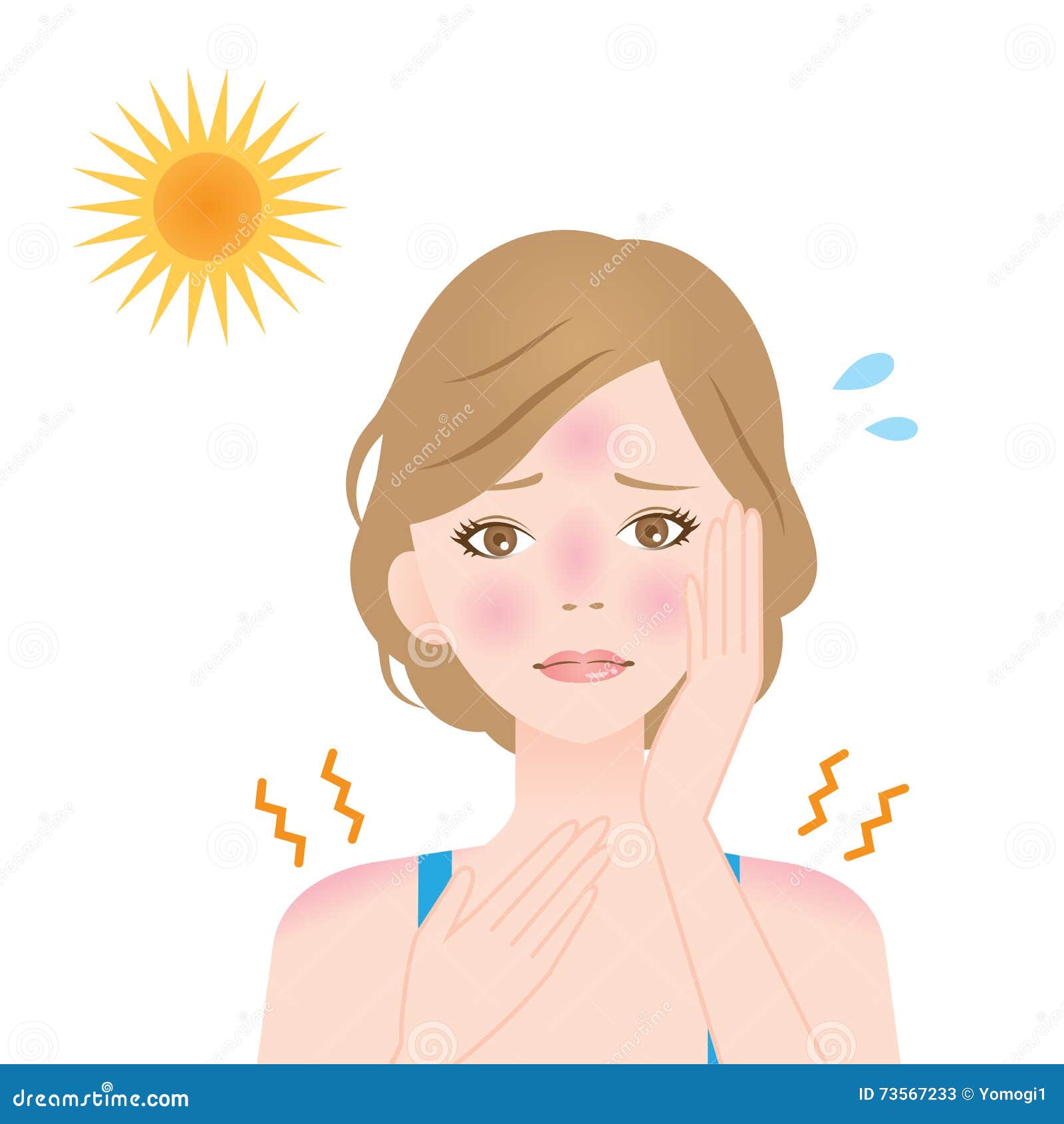 Sunburns Cartoons Illustrations And Vector Stock Images 22 Pictures To