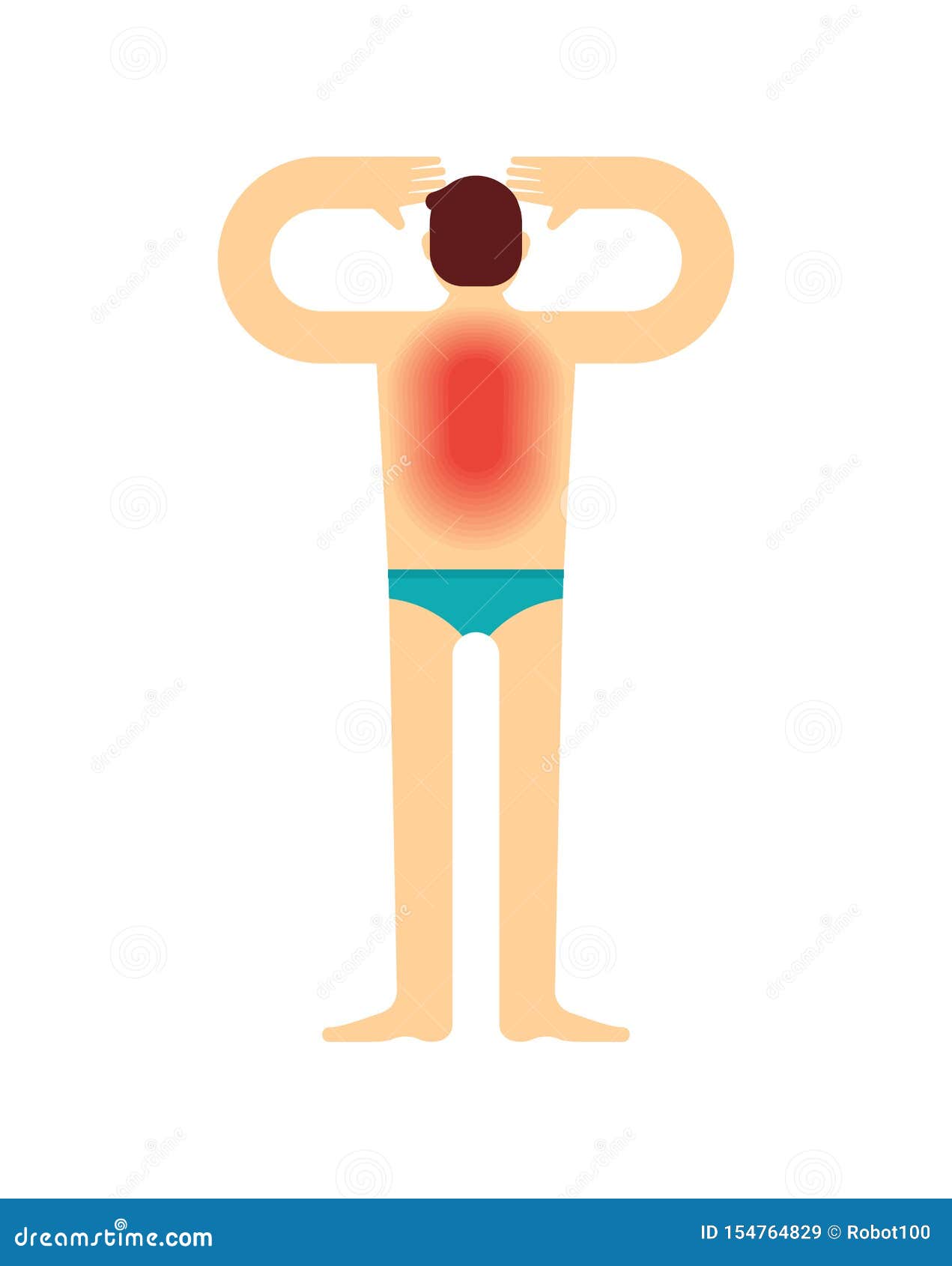 Sunburned Male Back. Burned Guy Back in Sun Stock Vector - Illustration ...