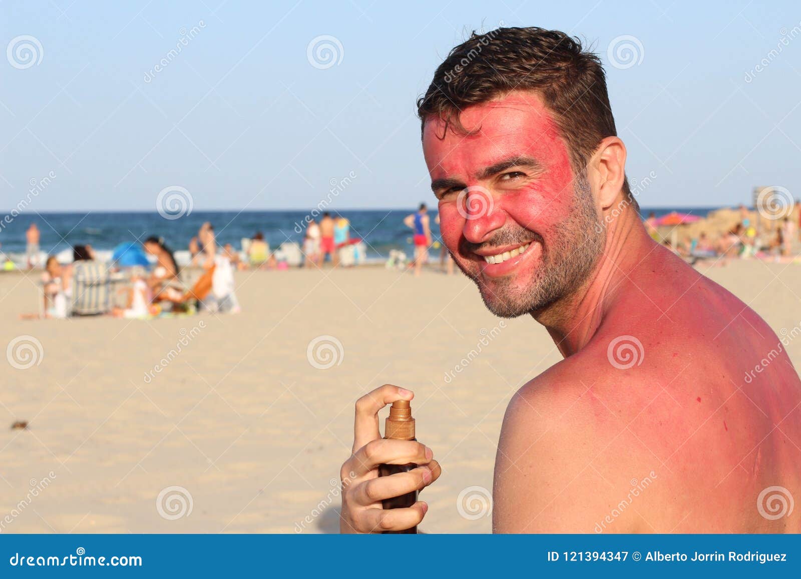 Sunburned Man Using Suntan Lotion Stock Image - Image of cancerous ...
