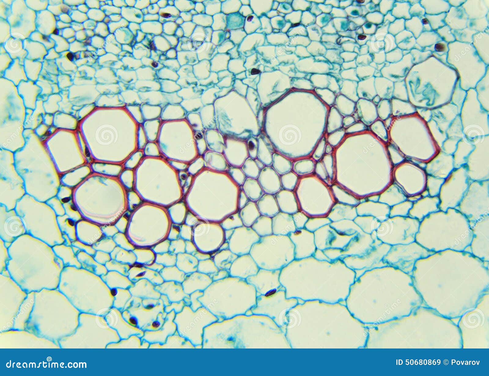 Sunflower Stalk Cross-section Under the Microscope, (Helianthus Stock ...