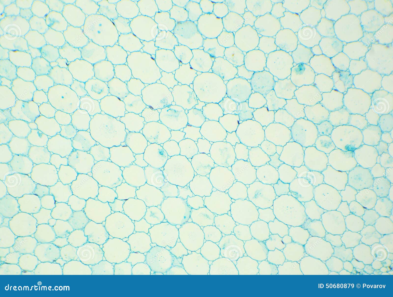 Sunflower Stalk Cross-section Under the Microscope, (Helianthus Stock ...