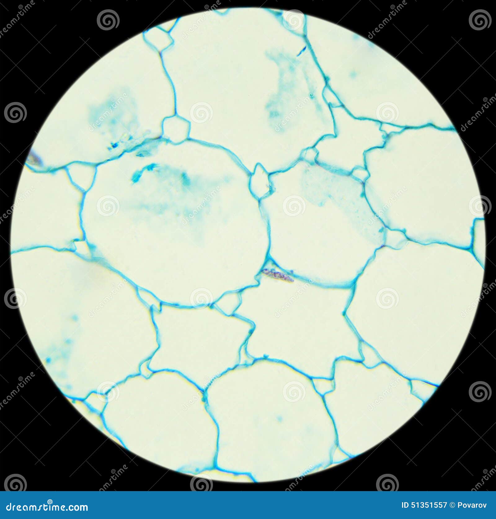 Sunflower Stalk Cross-section Under the Microscope, (Helianthus Stock ...