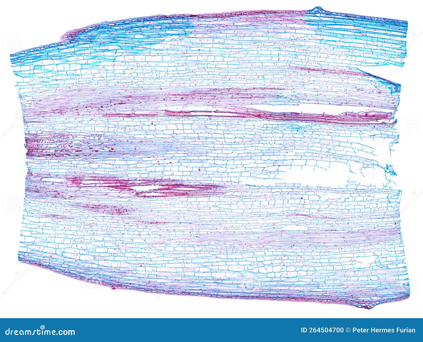 Sunflower Stem, Helianthus Annuus, Longitudinal Section, 20X Micrograph ...