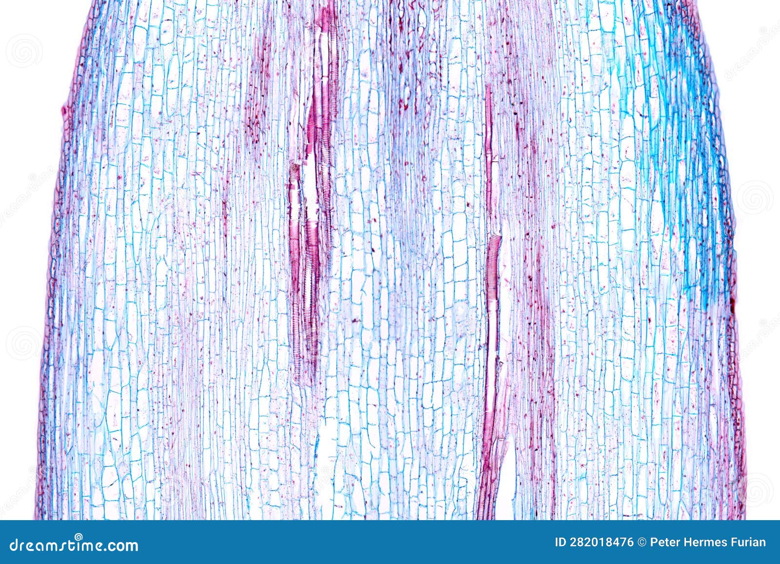 Sunflower Stem, Helianthus Annuus, Longitudinal Section, 20X Micrograph ...