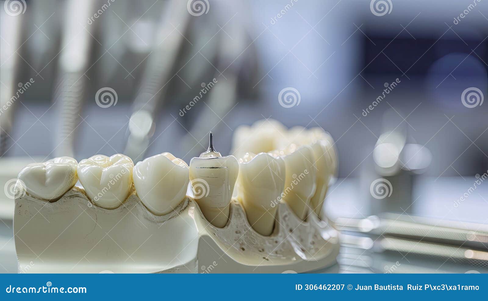 Sunlight Streams Onto Dental Tools and an Educational Molar Tooth Model ...