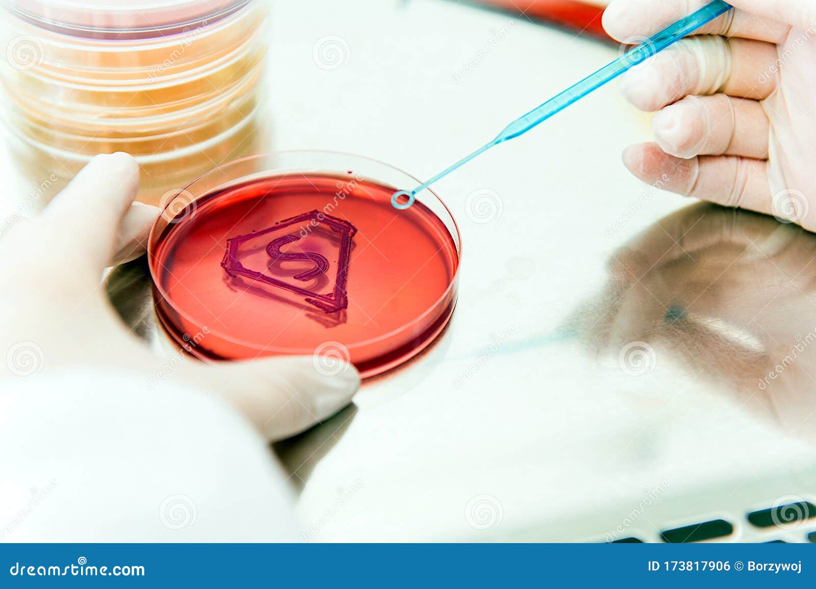 Super pathogen in lab stock photo. Image of dish, loop - 173817906