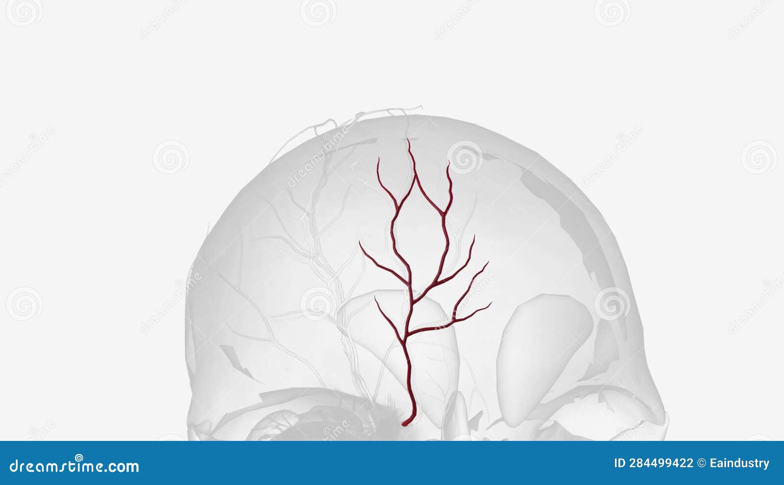 The Supratrochlear Artery (or Frontal Artery) is One of the Terminal ...