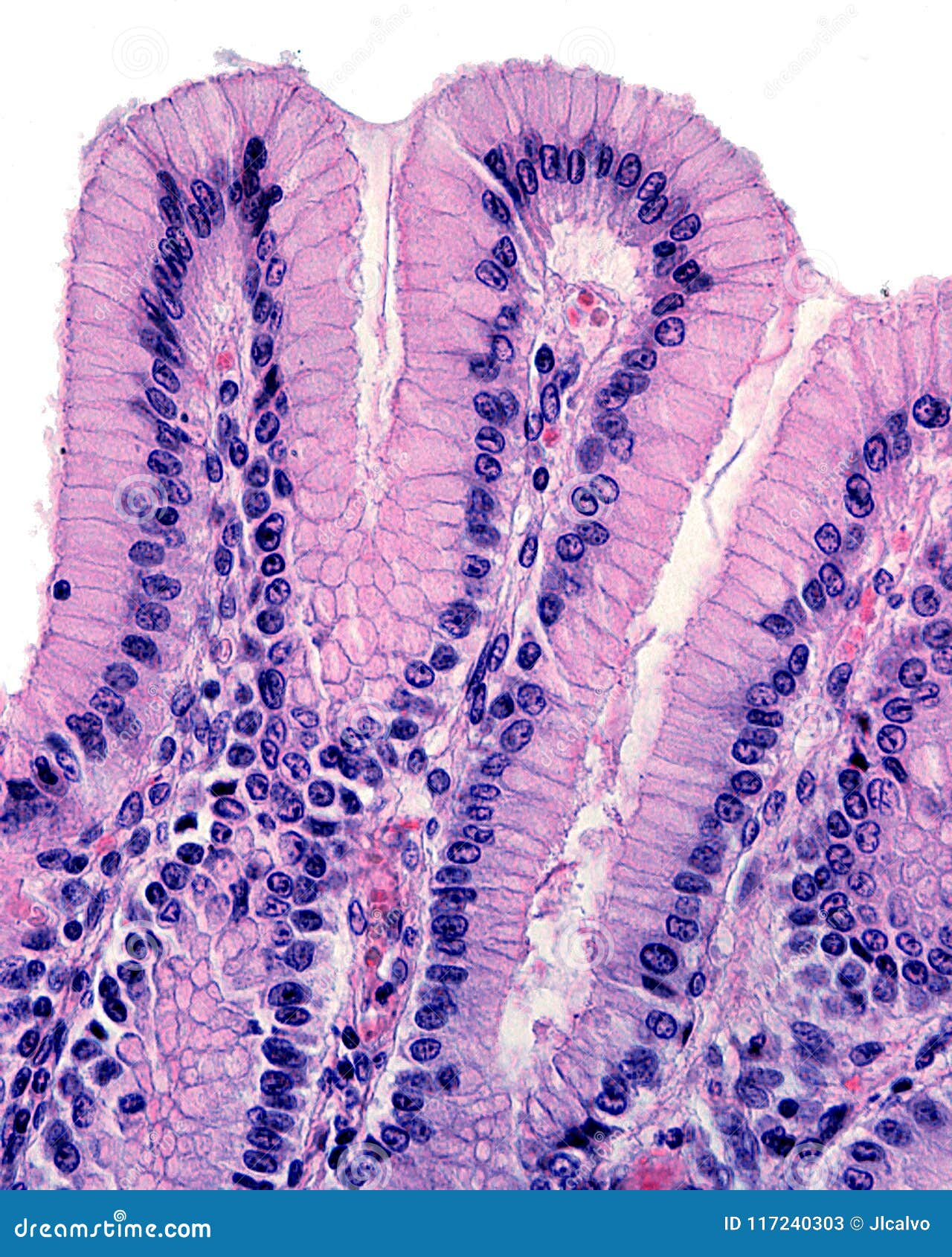 Goblet Cells In Stomach