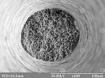 Needle Tip Surface Structure - 6 Stock Photo - Image of structure ...