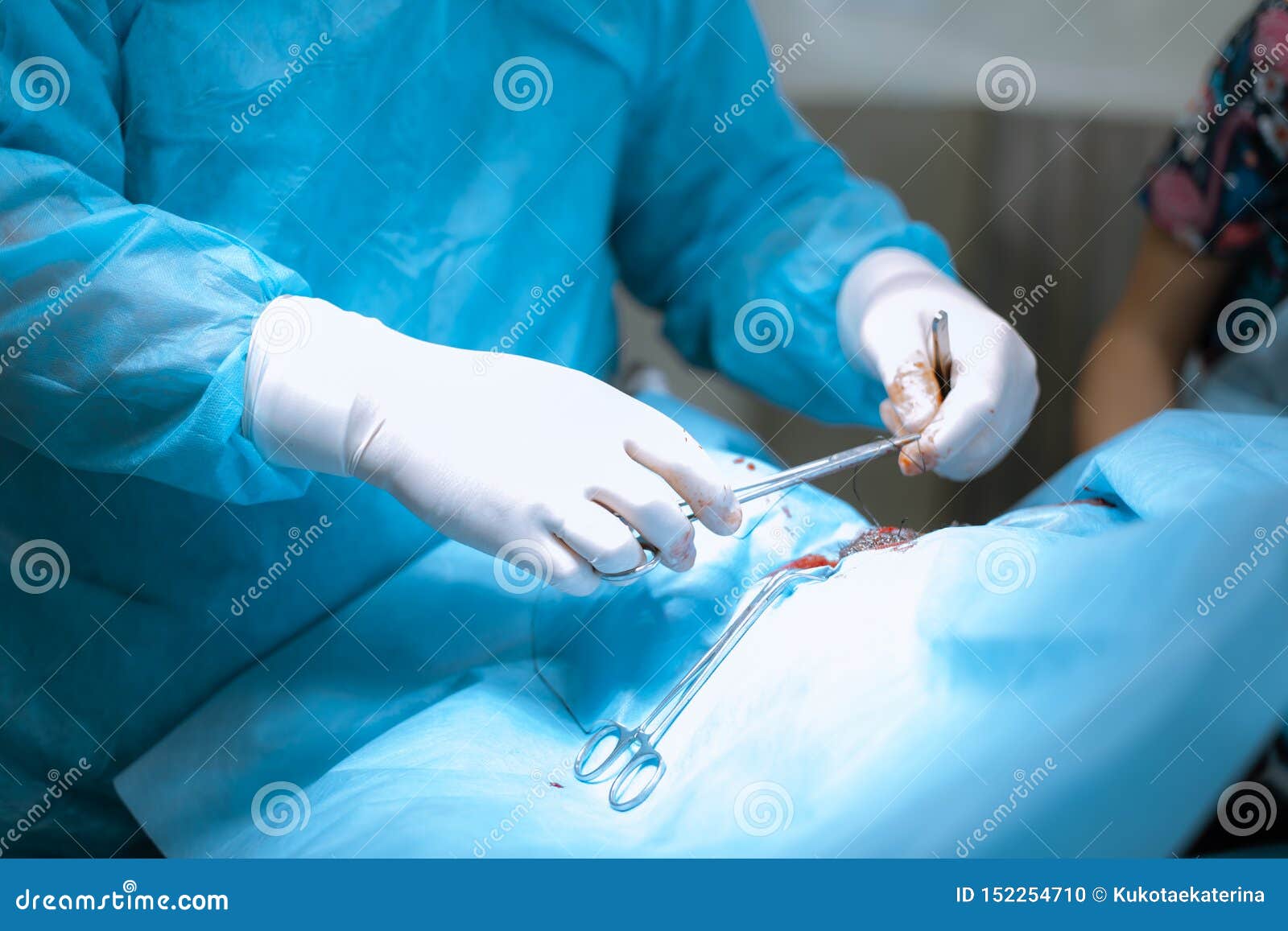 The Surgeon Applies a Surgical Clamp To Stop the Bleeding. Group of ...