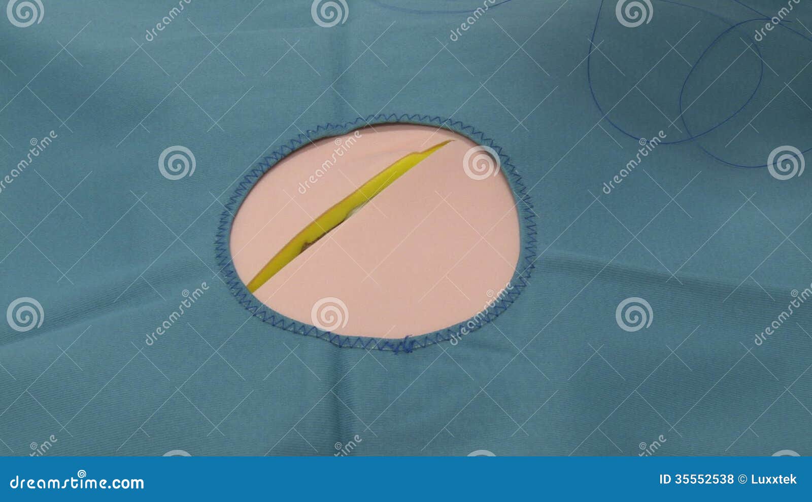 Surgeon Exercising Stitching Stock Footage - Video of surgeon, gloves ...