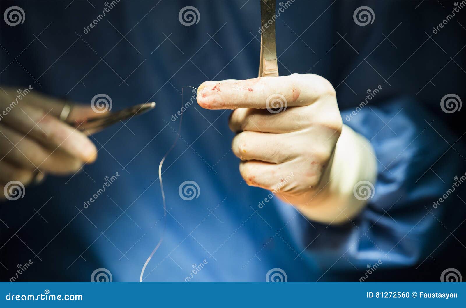 Surgeon Holding a Needle and Thread Stock Photo - Image of patient ...