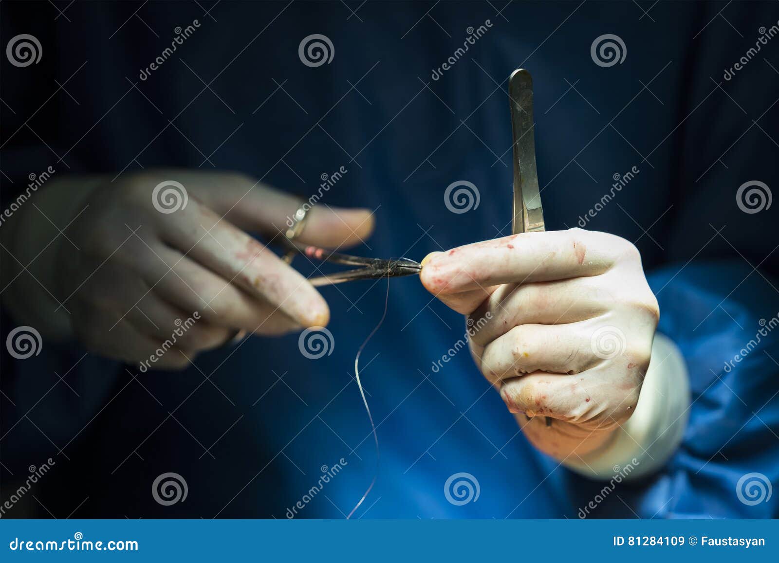 Surgeon Holding a Needle and Thread Stock Image - Image of equipment ...