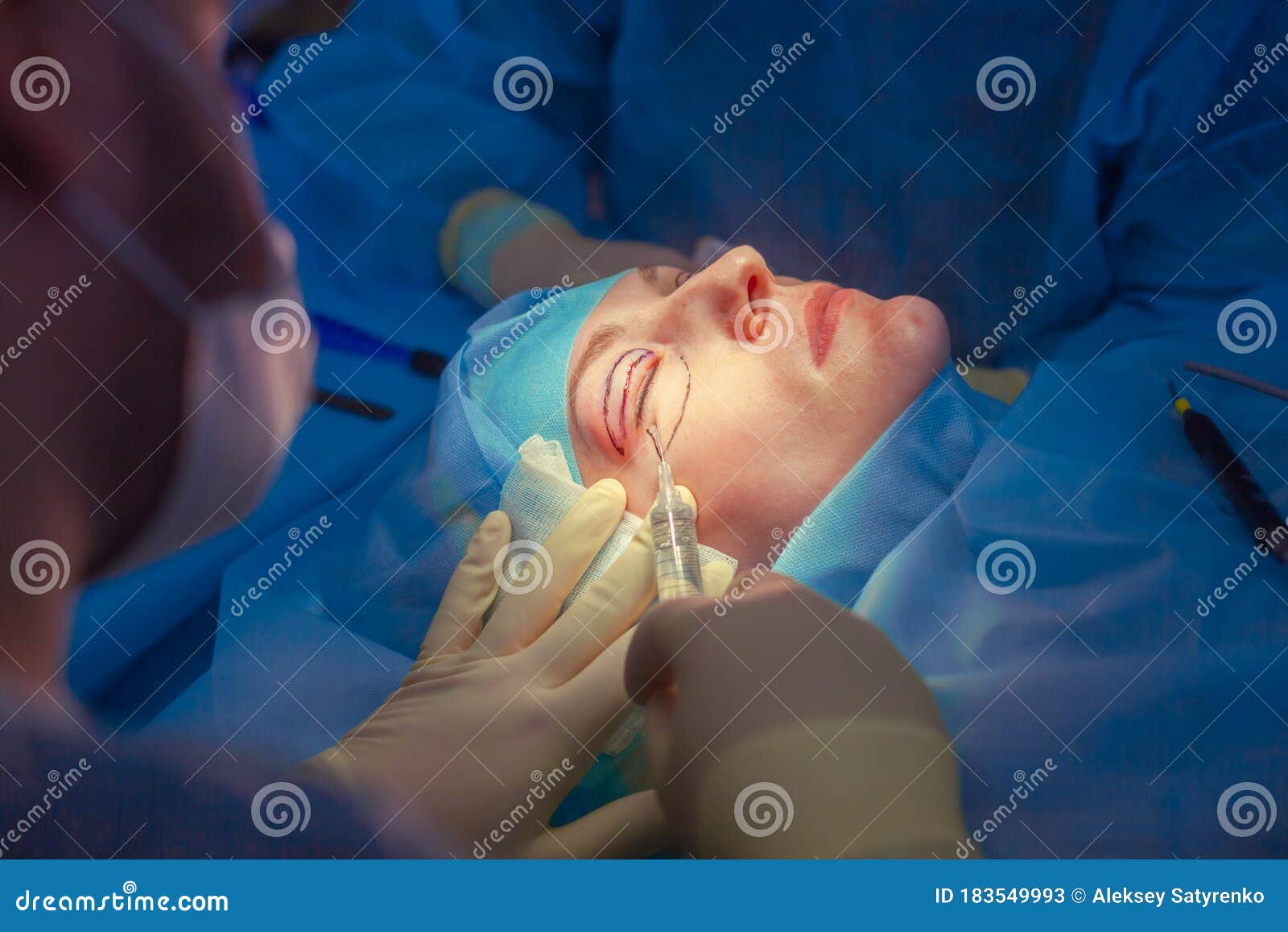 Surgeon Inserts an Injection into the Upper Eyelid of the Patient ...