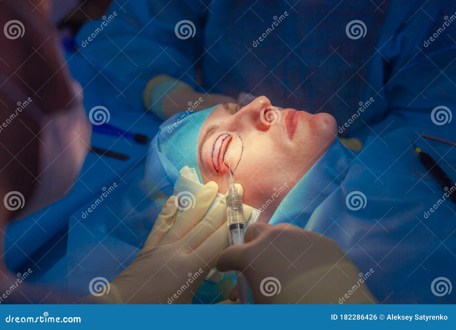 Surgeon Inserts an Injection into the Upper Eyelid of the Patient ...