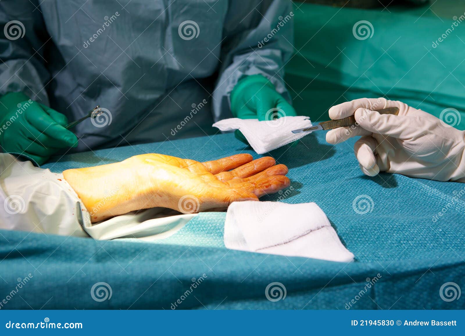 Surgeon and Nurse Performing Hand Operation Stock Photo - Image of care ...