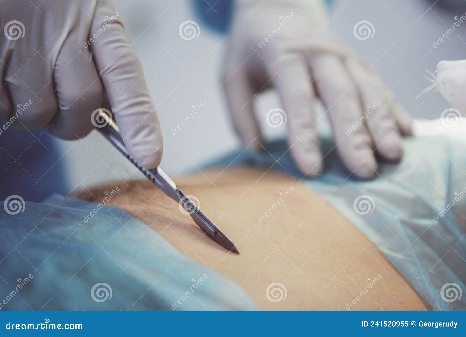 A surgical procedure stock image. Image of instrument - 241520955